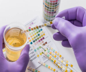 All You Need To Know About Urine Tests And Other Body Fluid Testing ...